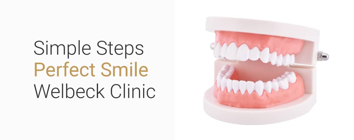 Achieving-The-Perfect-Smile – The Welbeck Clinic