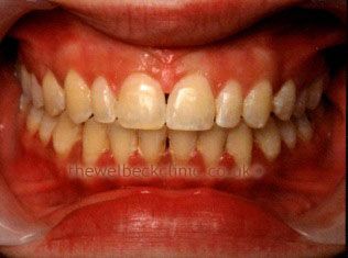 ortho-2-after – The Welbeck Clinic