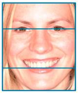 smile-rules-1 – The Welbeck Clinic