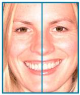 smile-rules-2 – The Welbeck Clinic