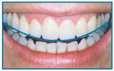 smile-rules-3 – The Welbeck Clinic