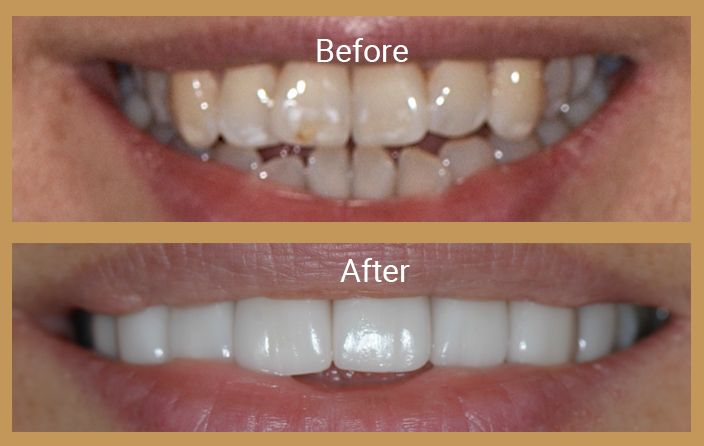 Discolouration-v5a – The Welbeck Clinic