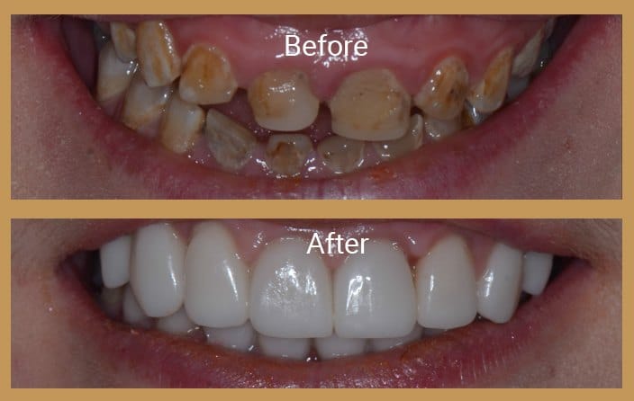 Gaps-v6a – The Welbeck Clinic