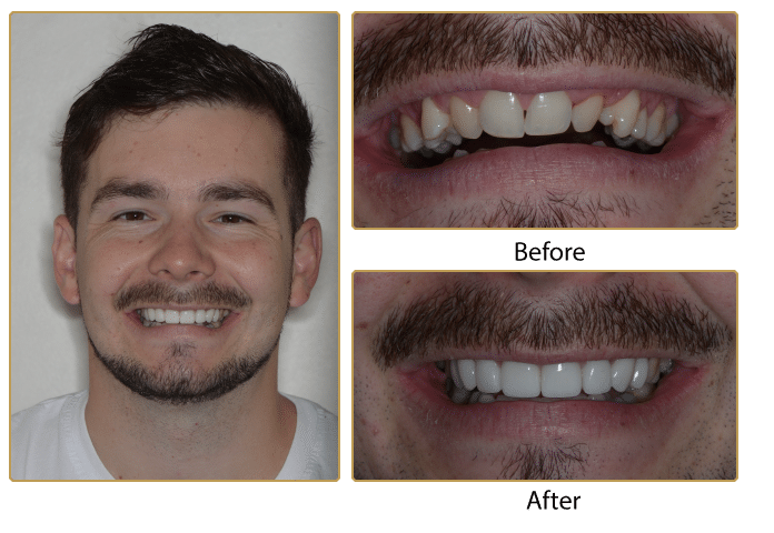 Cosmetic Dentistry: Changing Lives, One Smile at a Time | The Welbeck ...